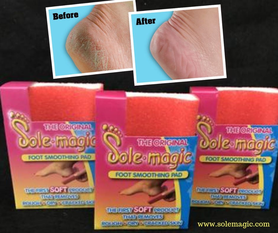 Skin Care | Sole-magic is the first SOFT & FLEXIBLE Foot File